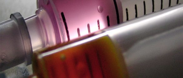 infiltraciones - https://medicinagaditana.es